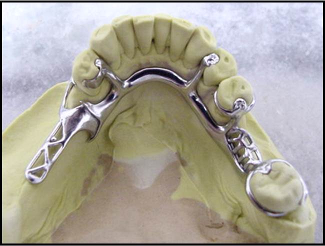 PPR :: RR Protese Dentária