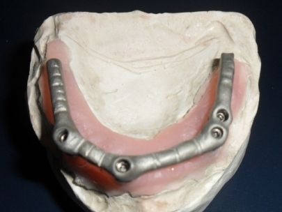 Barra de Protocolo :: RR Protese Dentária